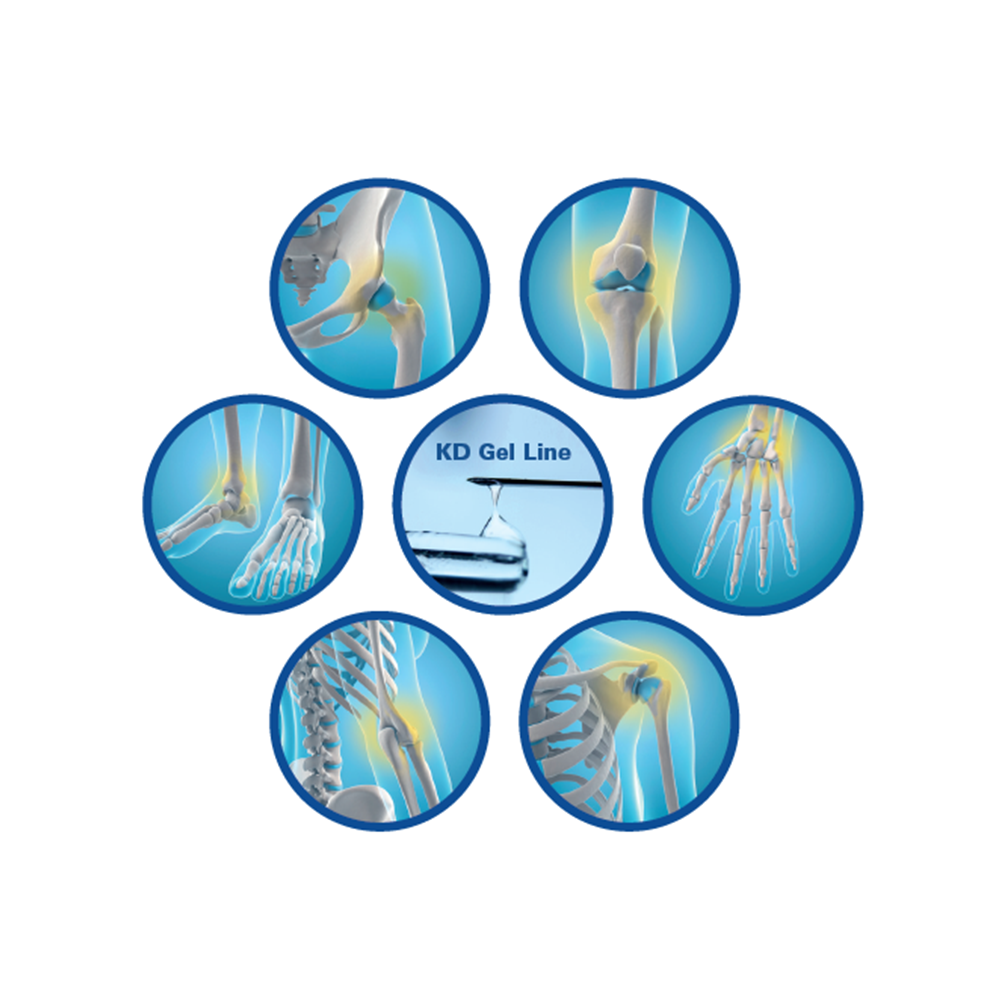 Gel intraarticular KD - Infiltratii intraarticulare